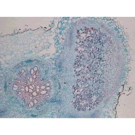Prepared Microscope Slide - Rhizobium Leguminosarum Section | Dryad ...